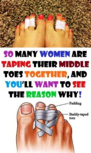 So Many Women Are Taping Their Middle Toes Together, and You’ll Want to ...